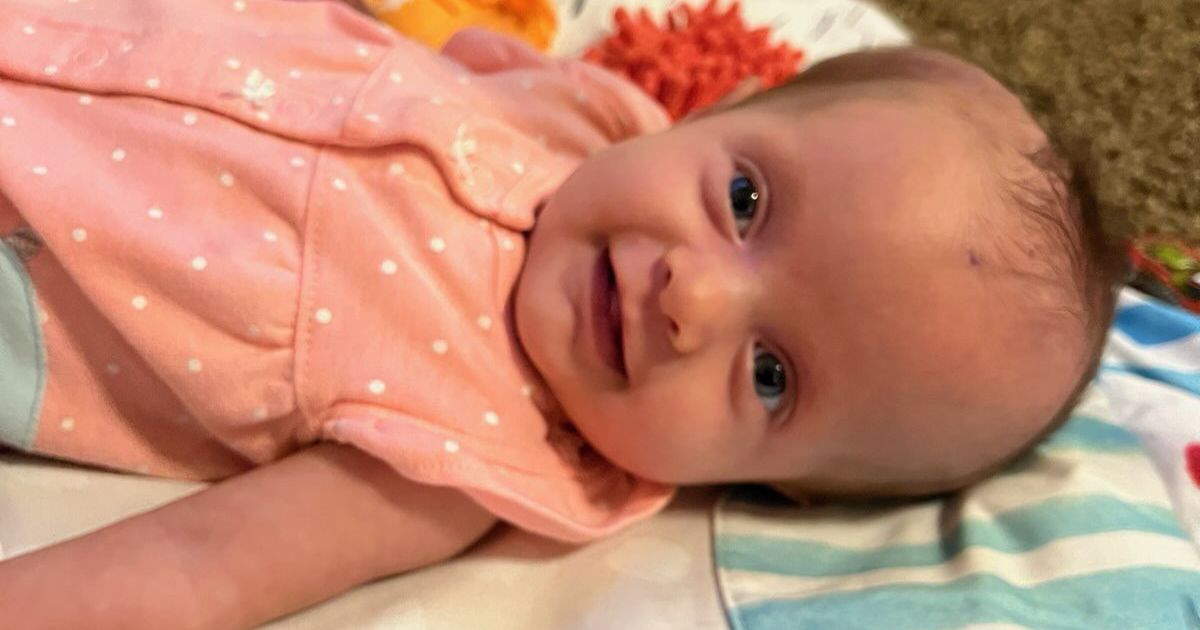 Congenital Hydrocephalus | Hydrocephalus Association