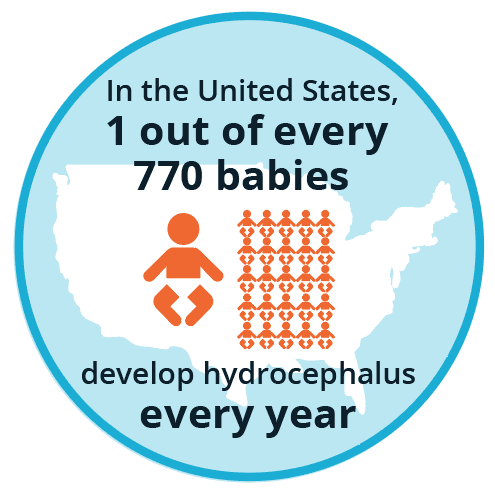 Hydrocephalus in Infants and Children: Diagnosis & Treatment