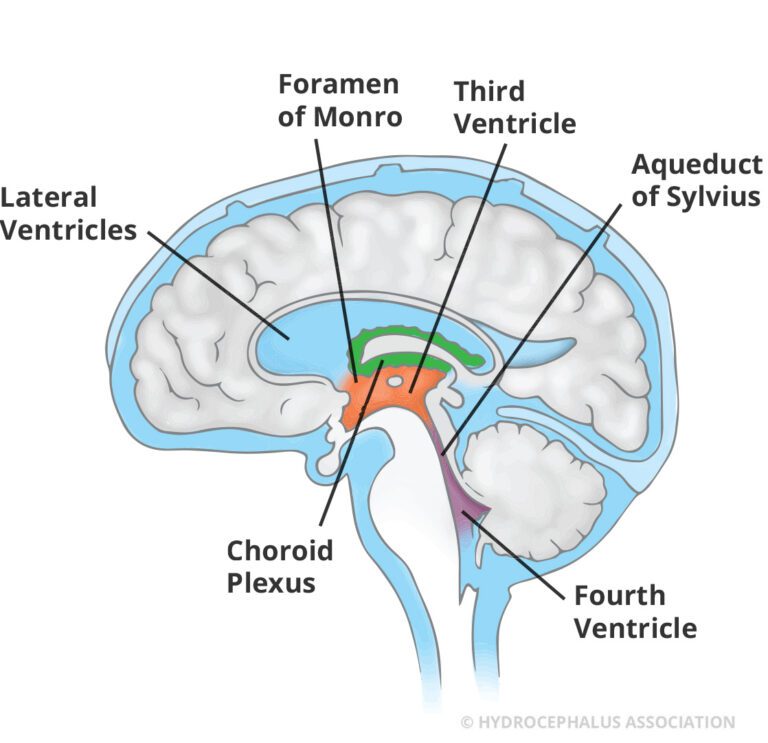 Understanding the Choroid Plexus: Function, Location, and Its Role in ...